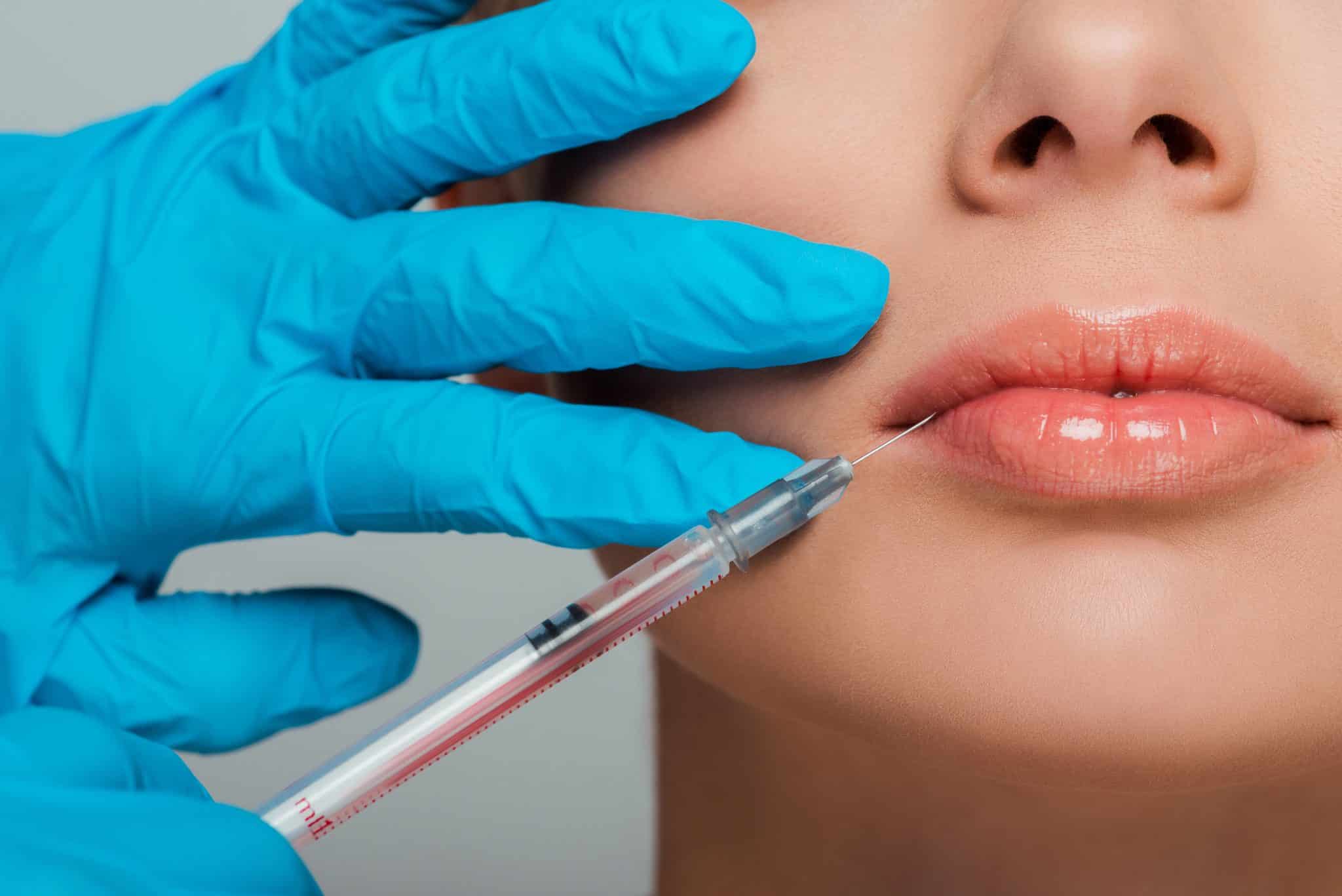The Pros and Cons of Lip Fillers - Botox Laser Hair Removal OxyGeneo ...